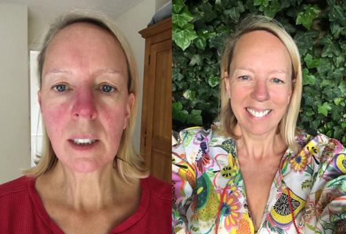 Finca Skin Organics